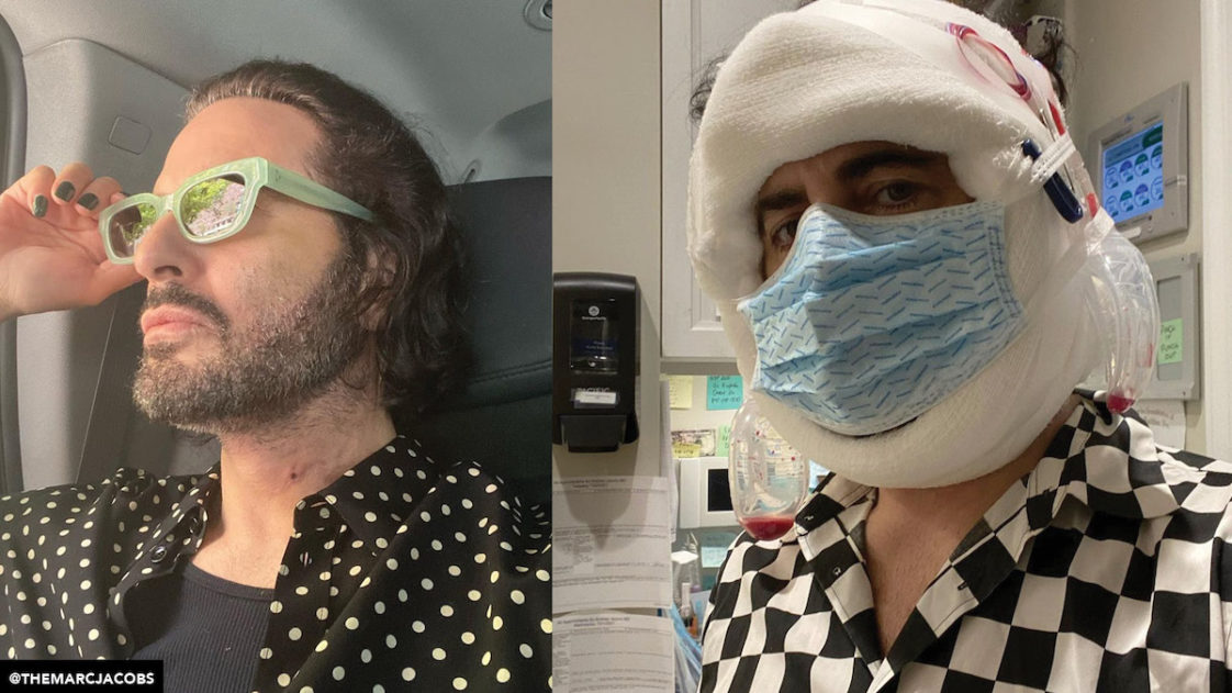 Marc Jacobs Takes On Gravity (and Reality) in $50,000 Facelift ...