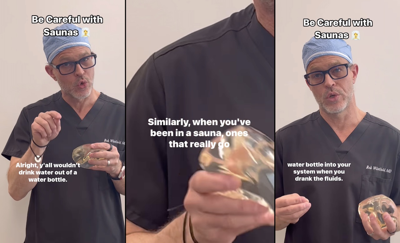 Saunas ‘Not Literally’ Melting Implants But Leaching Metals ...