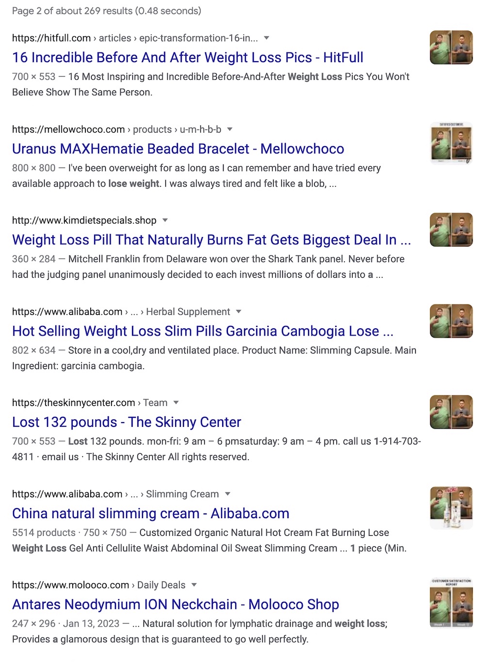 Ads Used Surgeon’s Work to Sell Non-Surgical Devices – Surgical Times