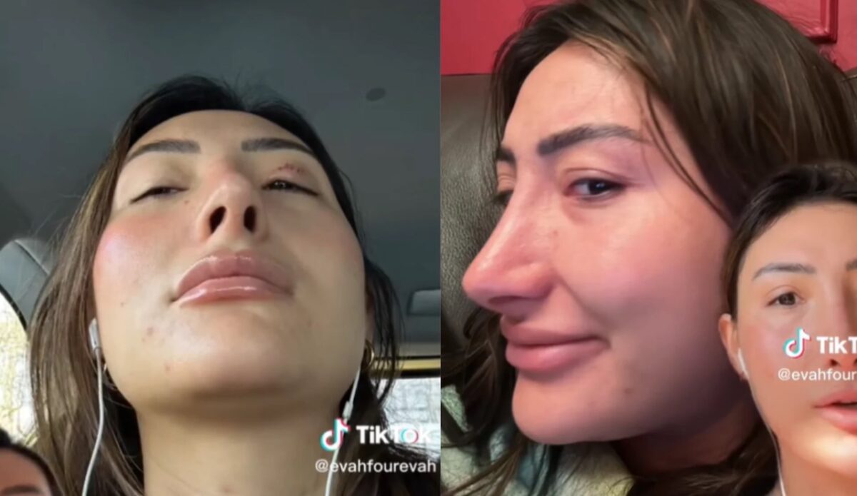 Surgeon Counters Claims he Botched Woman's Nose, Deletes Bad Reviews ...