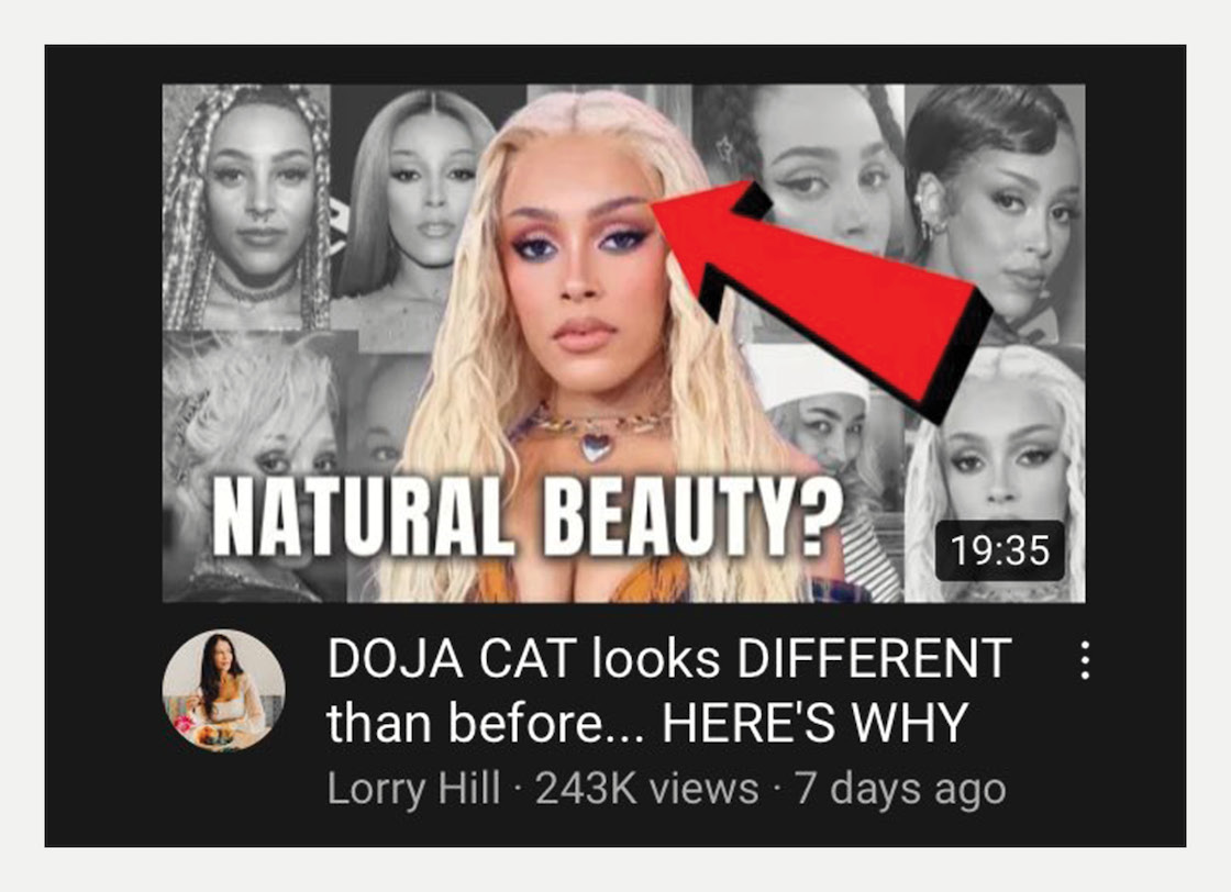 Doja Cat Takes Up Plastic Surgery Speculations – Surgical Times