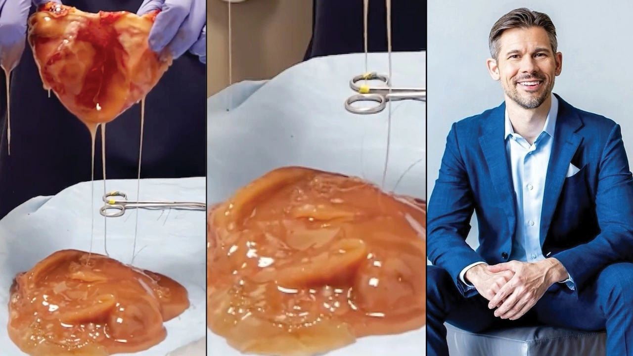 Industrial-Grade Silicone ('PIP') Breast Implants Made Woman Ill ...