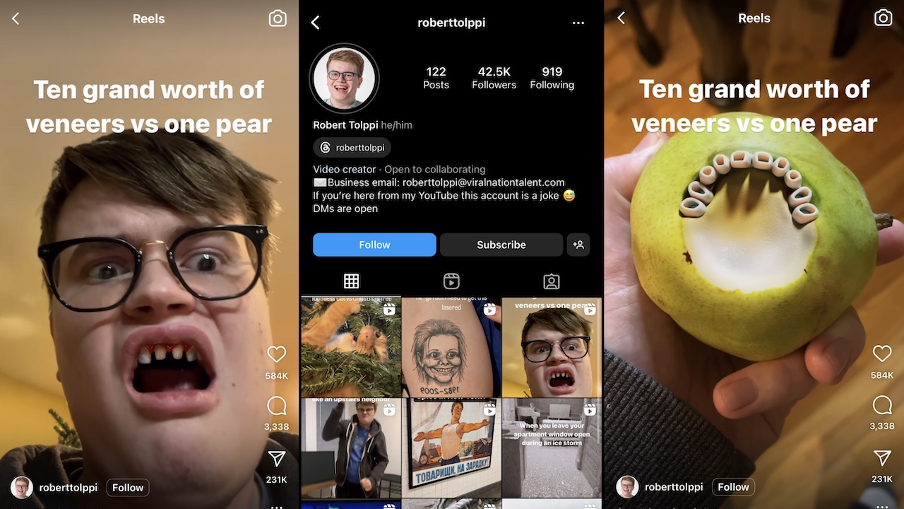 48-Million Views: Hyper-Viral Video of Veneers Versus Pear is, in Fact… – Surgical Times