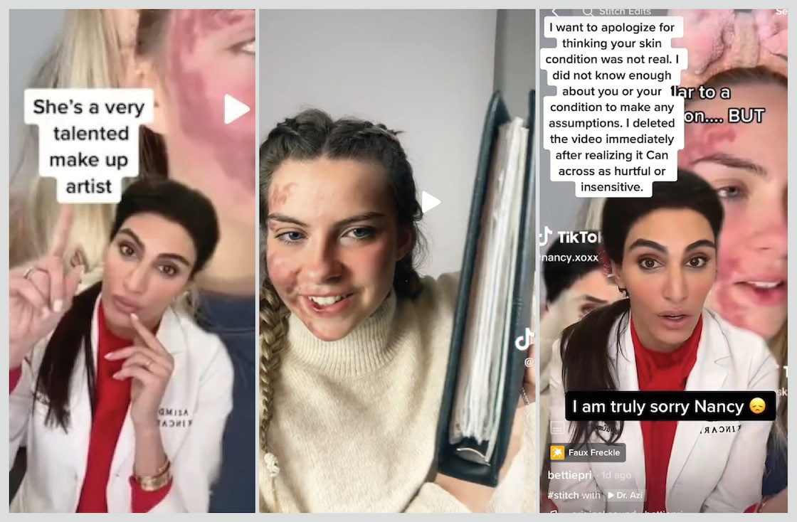 TikTok Derm Called Out for ‘Medical Gaslighting’ - Surgical Times