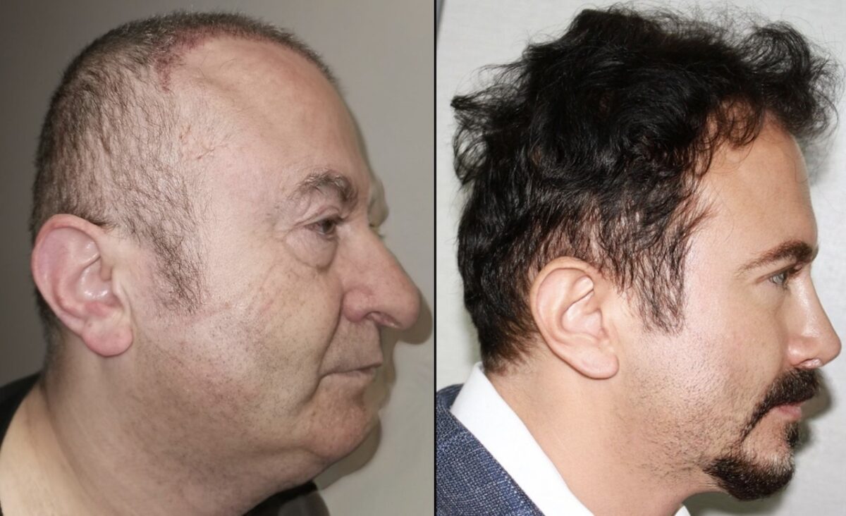 Twitter Torn Over Turkish Plastic Surgery Pics, Photoshop, Again ...